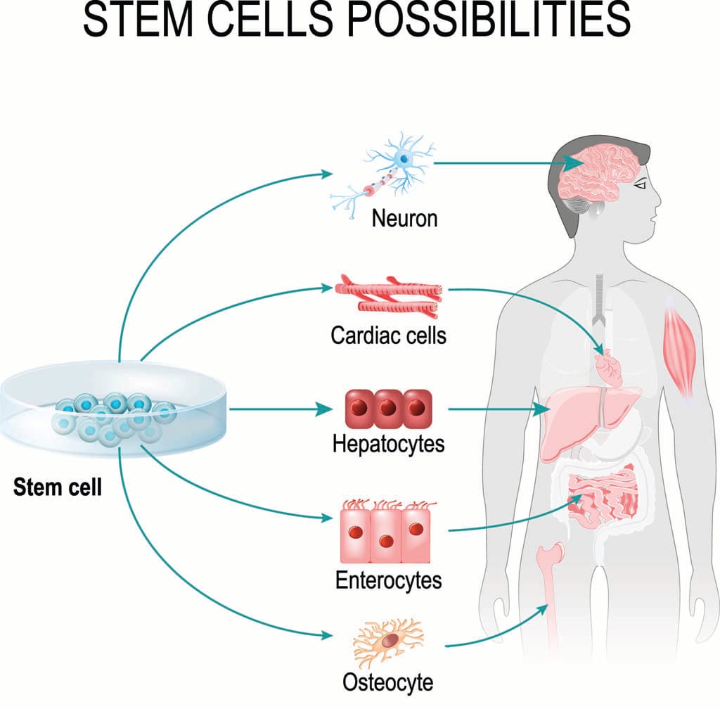 Stem cell therapy - CrystalMC